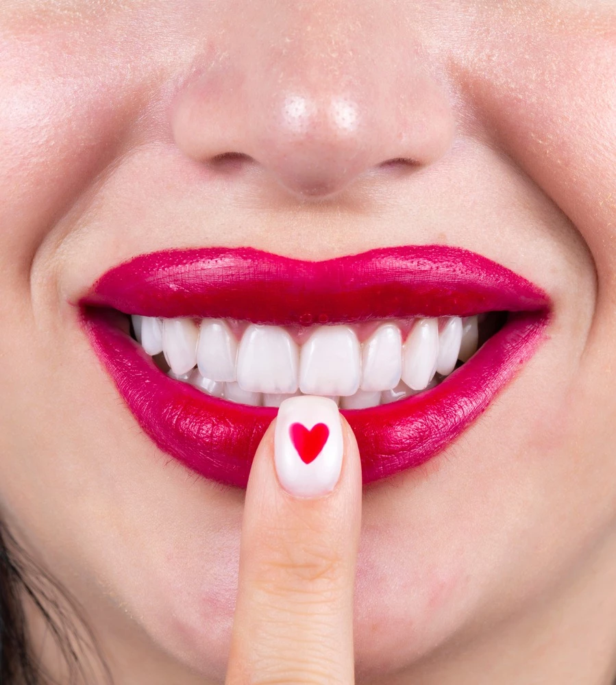 The evolution of the Hollywood smile: from temporary veneers to ... The evolution of the Hollywood smile: from temporary veneers to ...