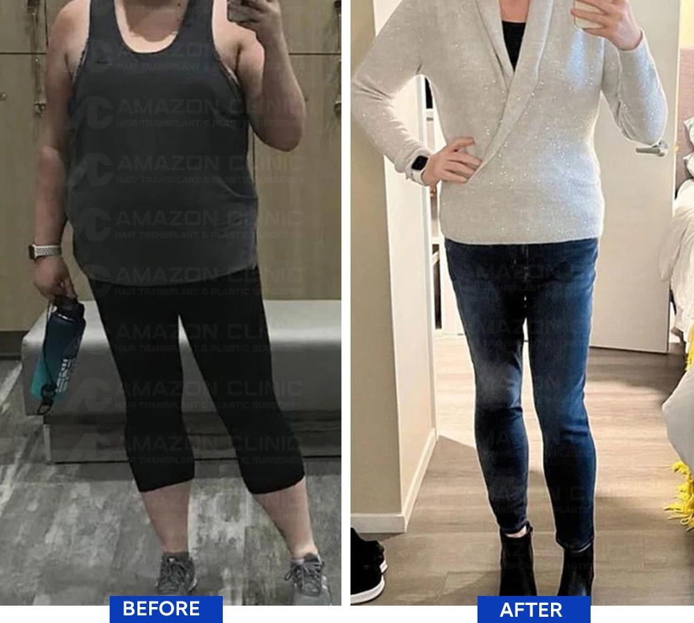 The Incredible Potential of Smart Capsule Procedure