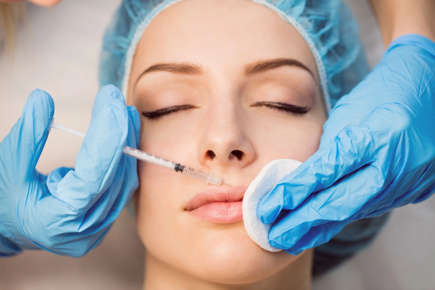 A Comprehensive Guide to Lip Lift procedure