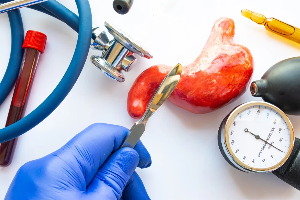 Losing Weight and Gaining Health: Gastric Sleeve Surgery