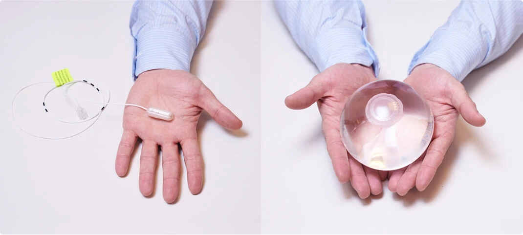 The Incredible Potential of Smart Capsule Procedure